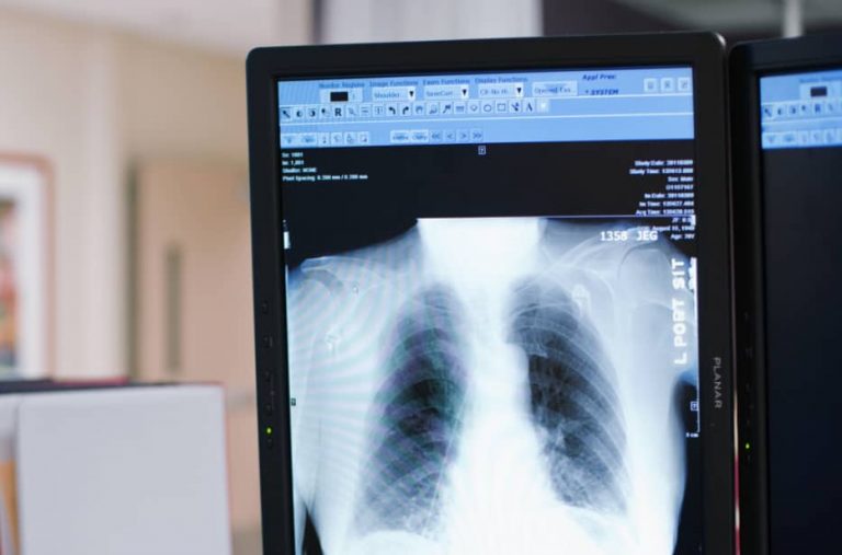 ClearRead CT - Riverain