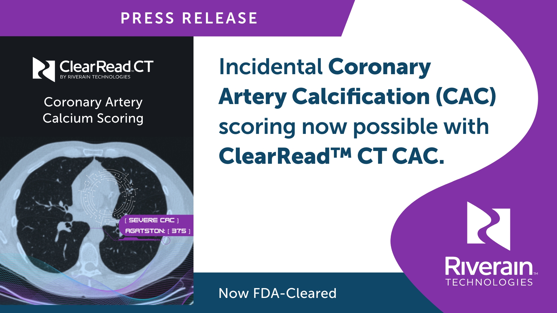 New Technology from Riverain Adds Coronary Artery Calcification Scoring ...