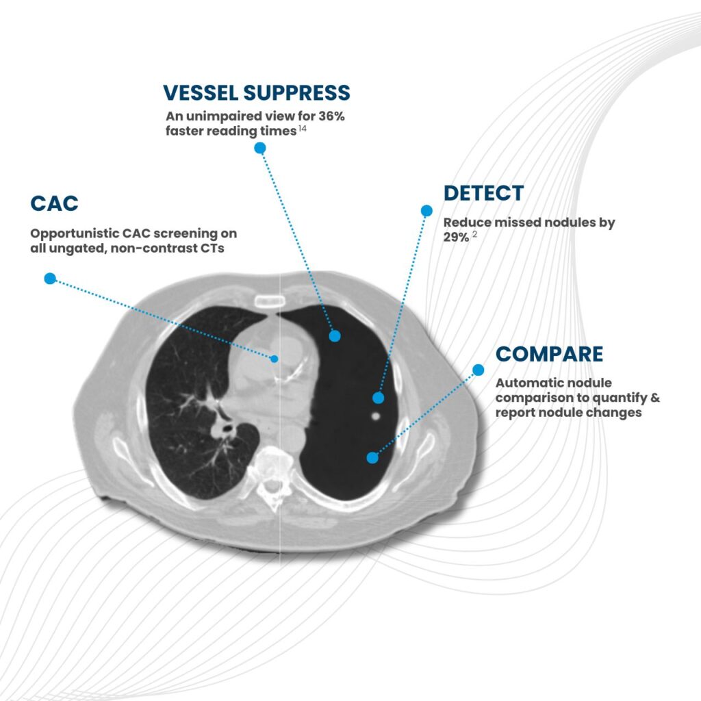 ClearRead CT - Riverain