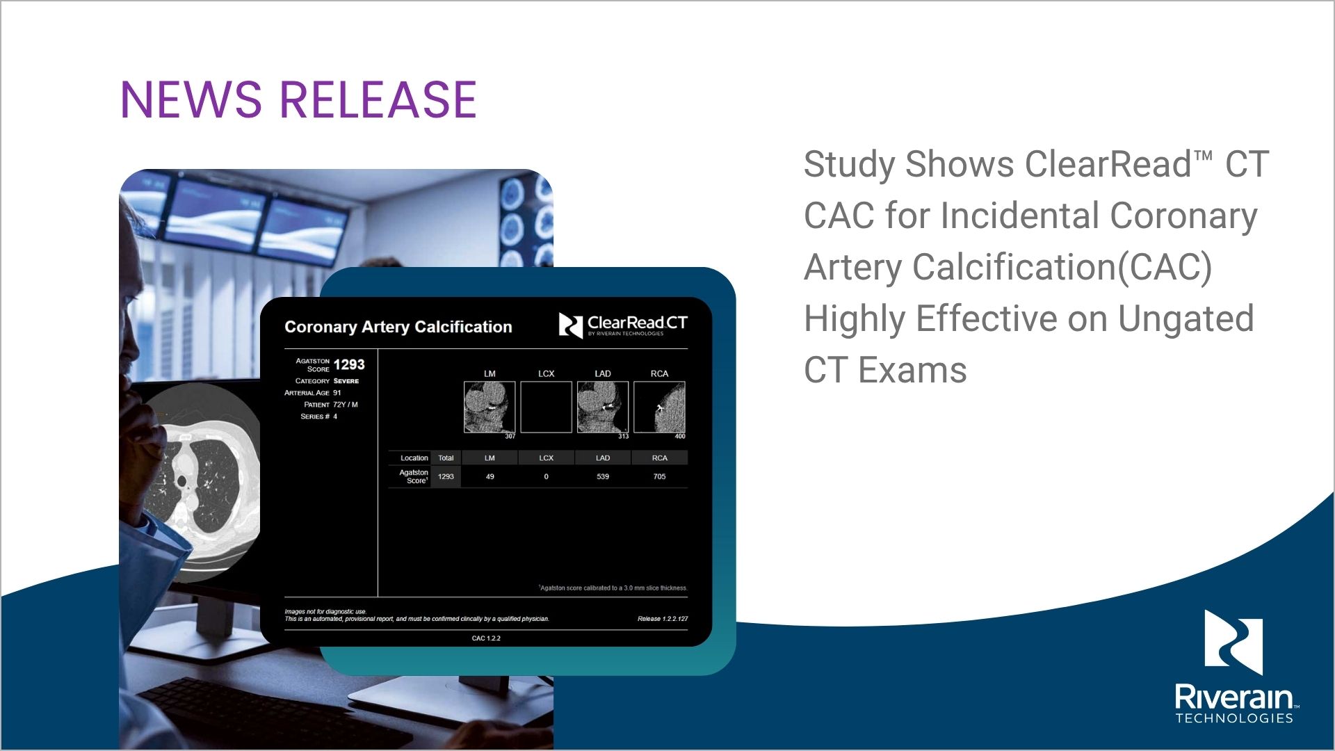 Study Shows ClearRead™ CT CAC for Incidental Coronary Artery ...